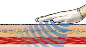 Deep Oscillation Therapy – HIVAMAT 200 | Simply Holistic Therapies